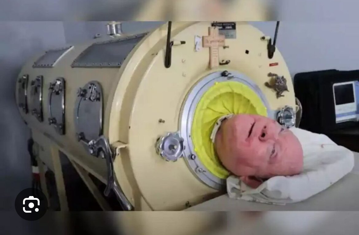 Le Héros Paul Alexander s'Éteint Après 72 Ans dans son 'Poumon d'Acier ...